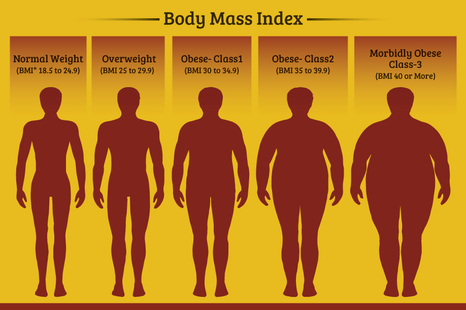 Morbid Obesity Barioss Centre Morbid Obesity Barioss Centre