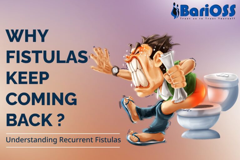 Why Fistulas Keep Coming Back: Understanding Recurrent Fistulas ...